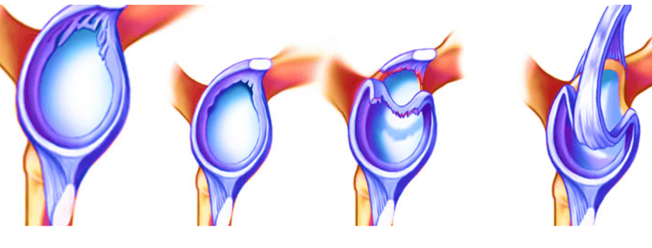 SLAP - יריב גולדשטיין